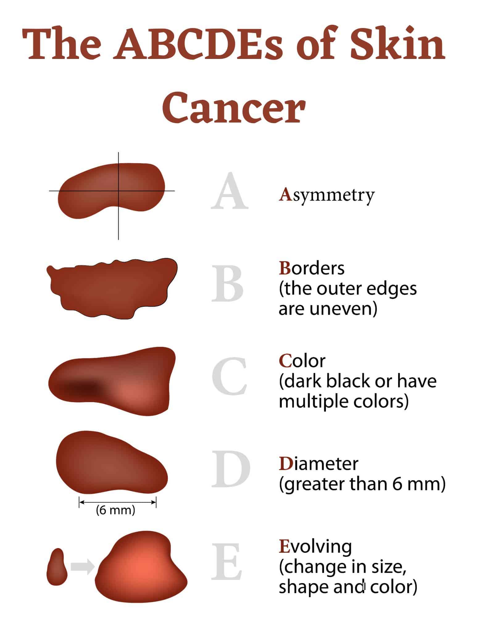 How to Spot Skin Cancer? - Gay Friendly